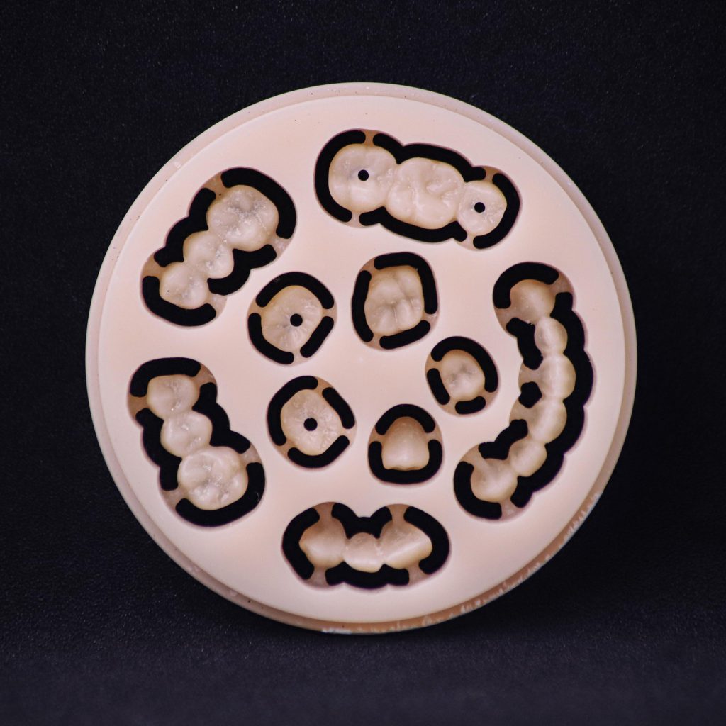 PMMA Crowns – micronmillingtech